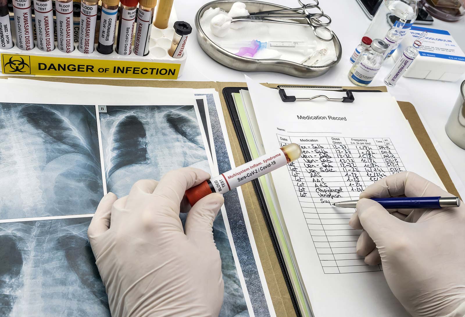 MIS-C Multisystem Inflammatory Syndrome in Children – Symptoms and ...