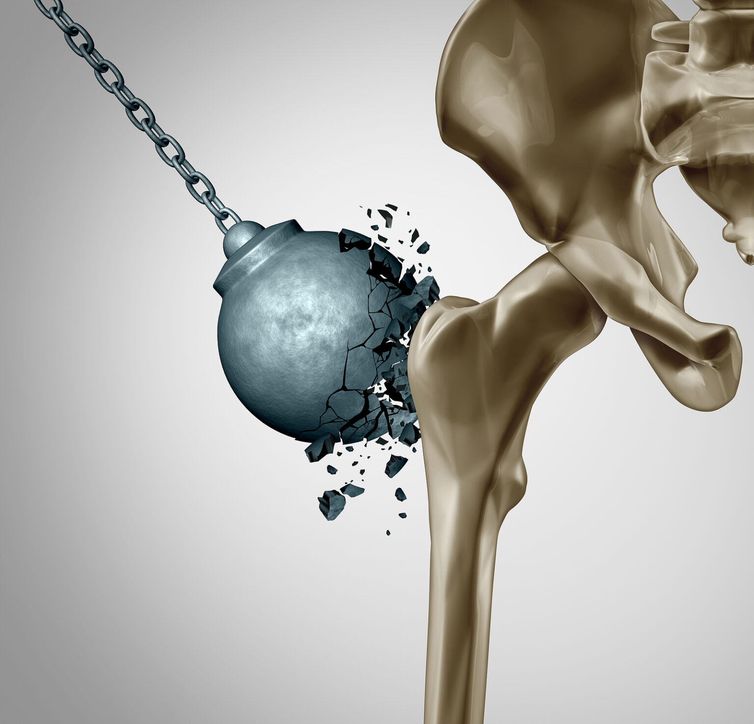 How To Keep Your Bones Healthy & Strong - Elite Hospital Kingwood